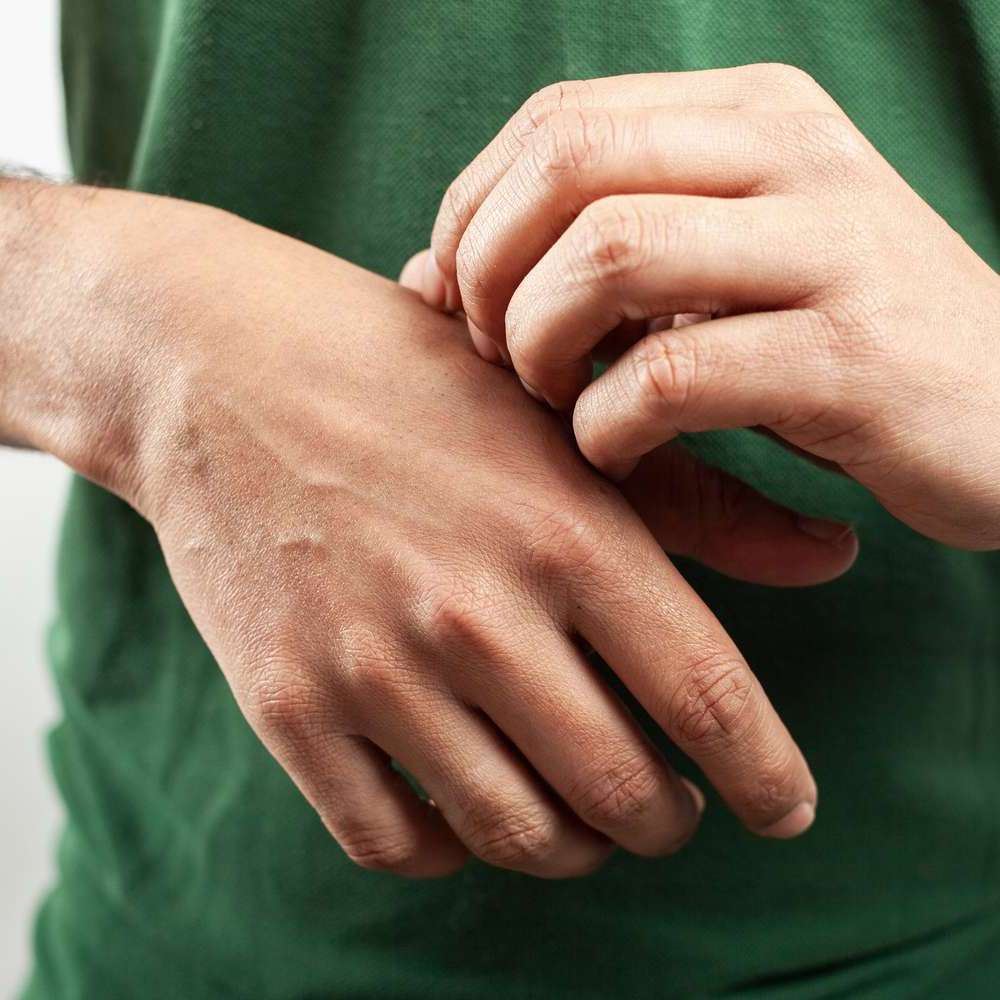 Top 7 Hidden Sources of Itchy Skin – Aether Health, London UK.